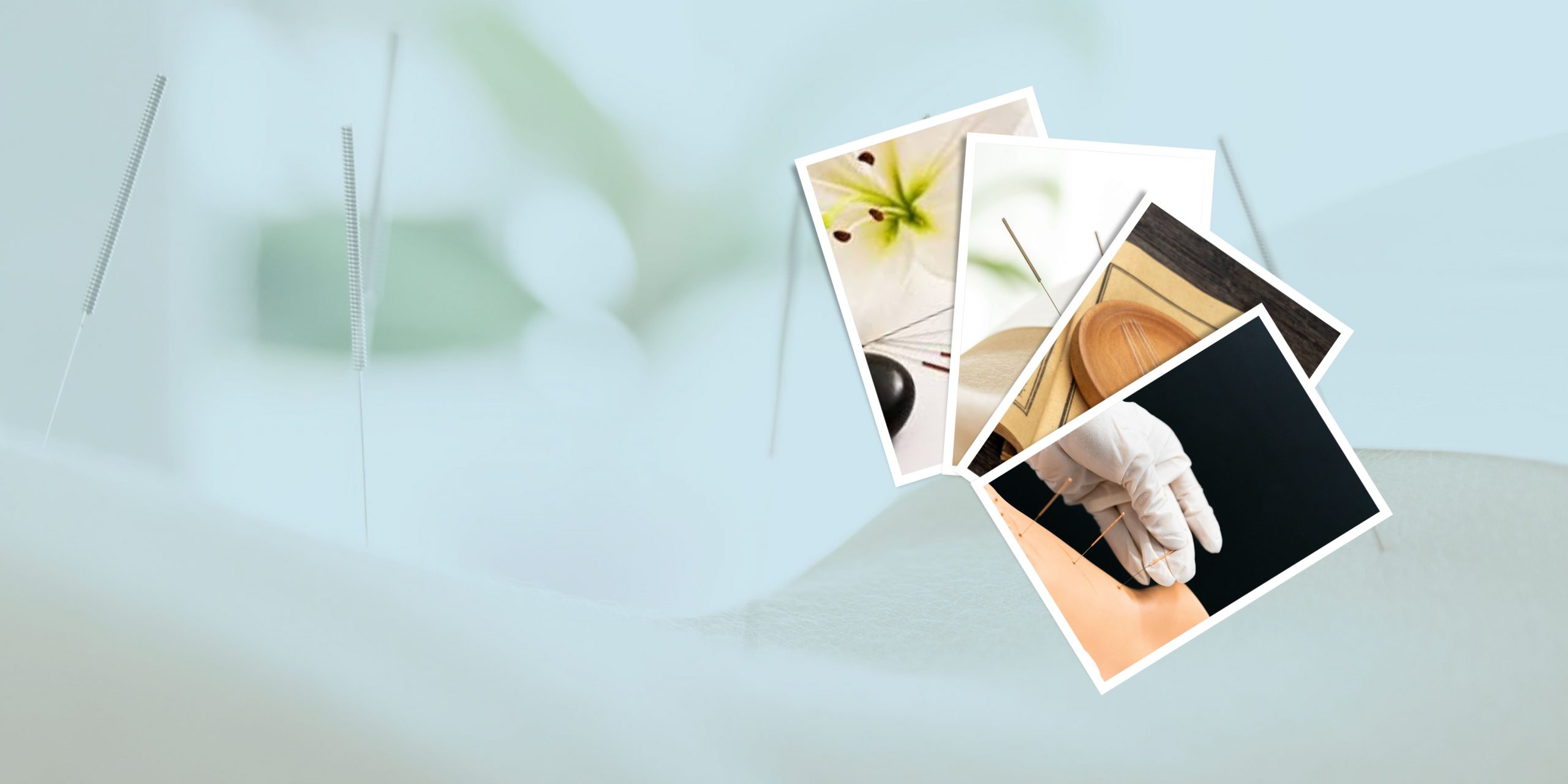 Acupuncture - Aurum Medicine & Wellness Clinic